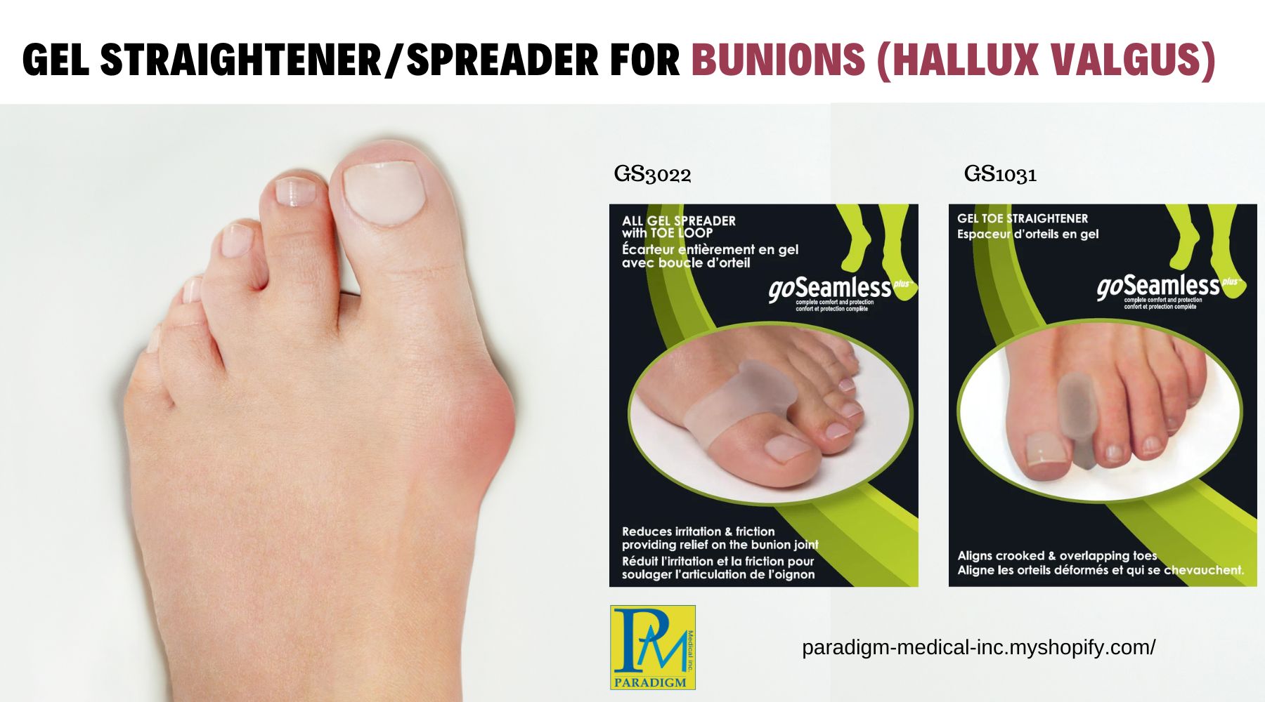 Suffering from Hallux Valgus Deformities (Bunions)?